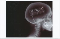 Forum list | PrinterKnowledge - Laser, 3D, Inkjet Printer Help